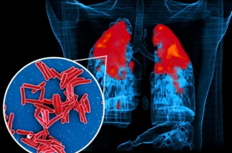 IIT Bombay study shows how TB bacteria shield themselves from ...